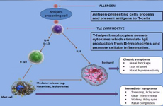 Specialist in All kinds of Allergic Treatment | ALEKHYA ENT CARE